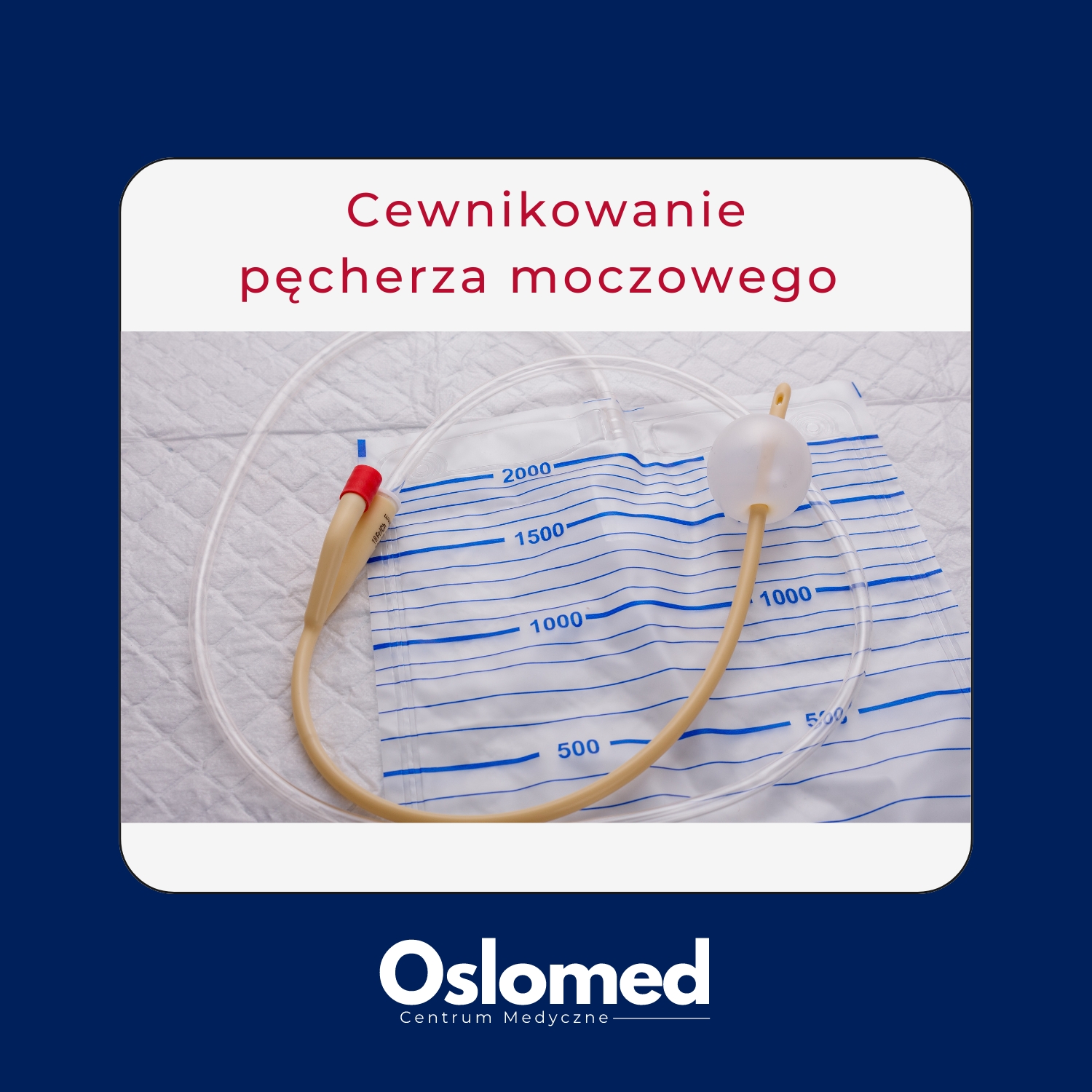 Cewnikowanie pęcherza Kraków – profesjonalne usługi urologiczne
